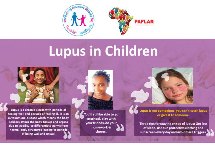 Lupus in children - PAFLAR